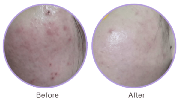 AGNES | Renovo Skin Clinic